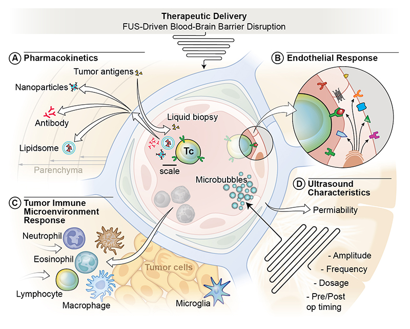 Improve Drug Delivery for Brain Tumor Patients | Brain Tumor Center